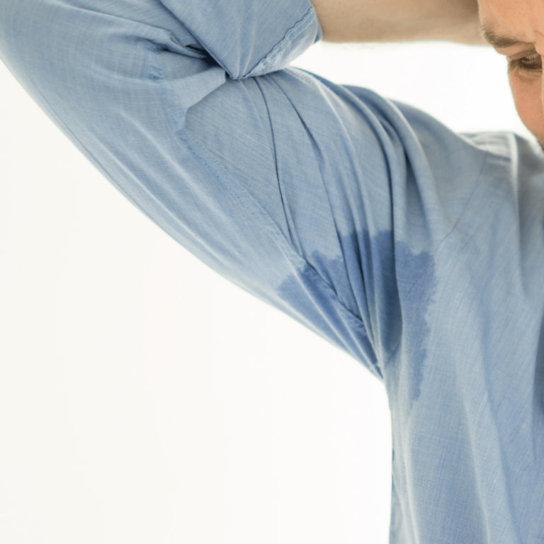 Híper hidrosis axilar – Doctora Mardones