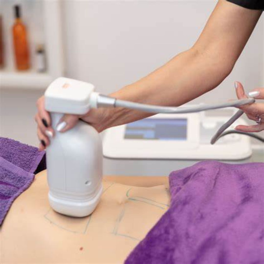 Lipoláser 10 sesiones – Doctora Mardones